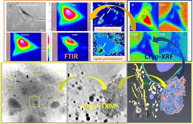Synchrotron light unveils new insights about amyotrophic lateral ...