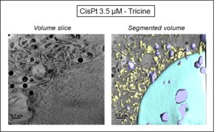 Tricine as a potential enhancer for cisplatin-based skin cancer ...